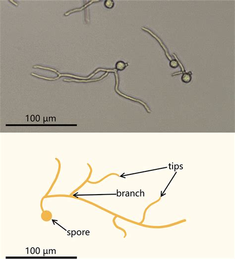 1 Microscopic Hyphal Growth Microscopic Image Top And Schematic