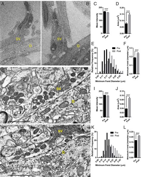 Mitochondria In Hippocampal Presynaptic And Postsynaptic Compartments Differ In Size As Well As