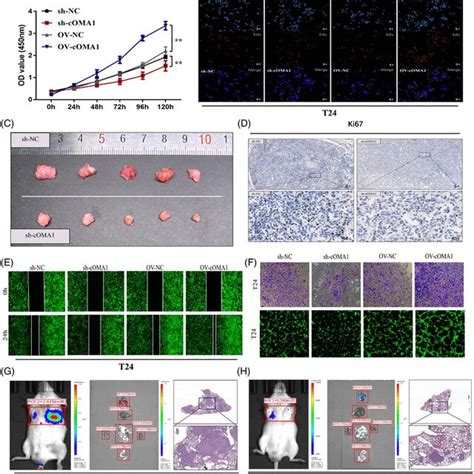 Circoma1 Promotes The Proliferation Invasion Migration And