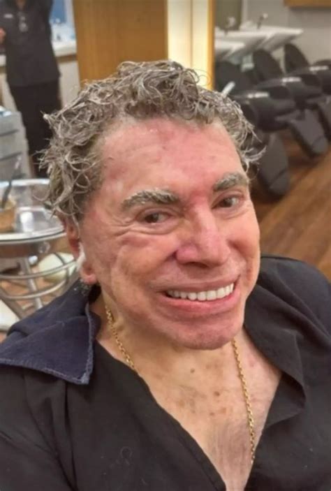 Silvio Santos Era Careca Saiba Origem Da Lenda