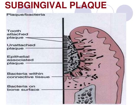 Ppt Dental Plaque Powerpoint Presentation Free Download Id9511546