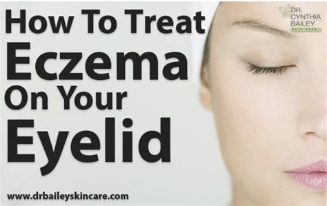 Eczema On Eyelids And Around Mouth At Steven Elli Blog