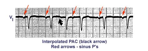 ECG Learning Center An Introduction To Clinical Electrocardiography