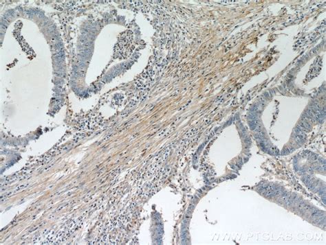 Fibronectin Antibody 15613 1 Ap Proteintech