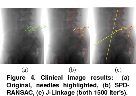 Figure 1 From Multiple Model Estimation For The Detection Of