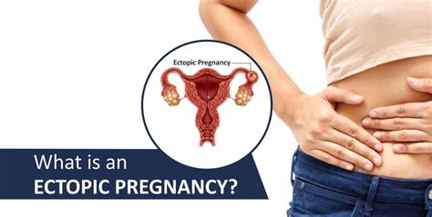Ectopic Pregnancy Thyroid In Women