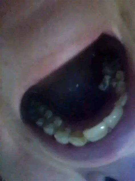 Help Fixing Teeth Gogetfunding