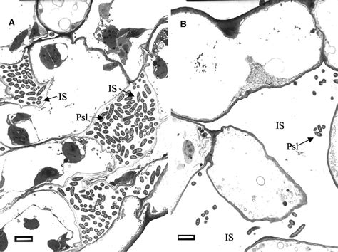 Transmission Electron Micrographs Of Ultrathin Sections From Cucumber