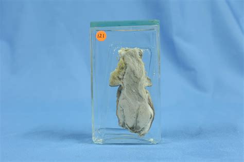 生殖疾病48 121 阴茎癌（总号：2714）病理标本博物馆 复旦大学基础医学院