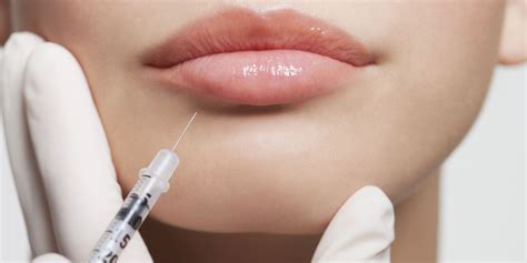 How Much Does Botox For Lips Cost