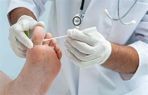Brittle Nails Review Causes Risk Factors And Natural Health Treatments