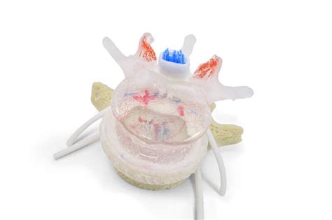 Replicating Spine Behaviours In A Model Accurately Simulating Spine