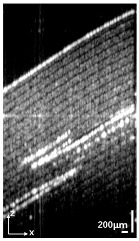 Speckle Reduced Optical Coherence Tomography Using A Tunable Quasi Supercontinuum Source