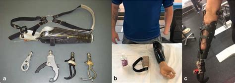 Common Designs Of Upper Extremity Prostheses For The Transradial Download Scientific Diagram