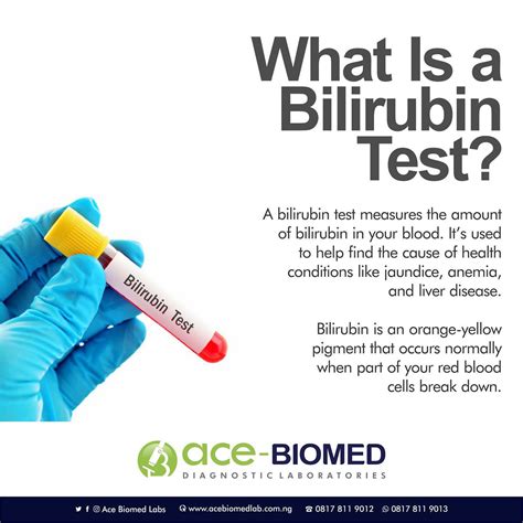 A Bilirubin Test Ace Biomed Diagnostic Laboratories