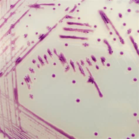 Chromagar L The Widest Range Of Chromogenic Media