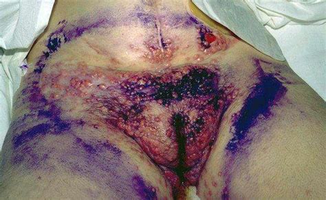 Plastic And Sex Change Surgery Info