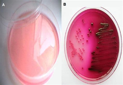 Endo Agar Composition Principle Preparation Results 49 Off