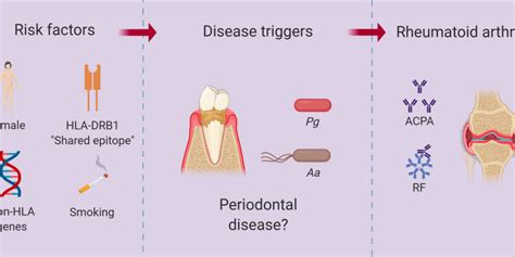 Periodontitis Unveils Deeper Relationship To Rheumatoid Arthritis