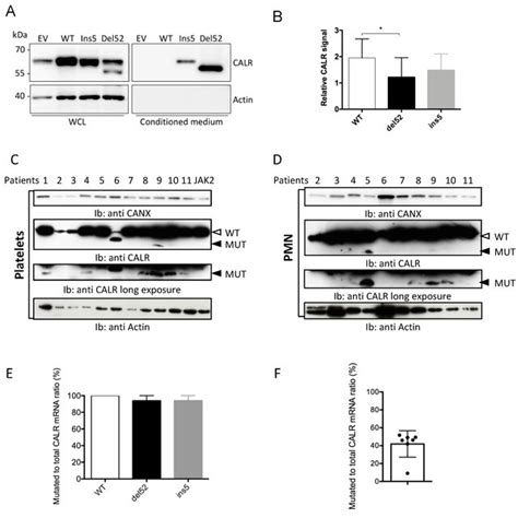 Calreticulin Calr Mutant Proteins Are Substrates Of Endoplasmic