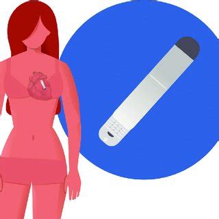 The Implantable Cardioverter Defibrillator ICD Delivers Shocks When Download Scientific