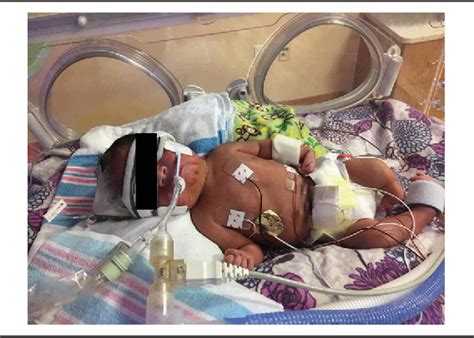 Figure 9 From Prenatal Sonographic Detection Of Multiple Congenital