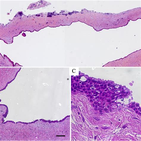Microphotographs Of Hematoxylin And Eosin Stained Sections In Case 2
