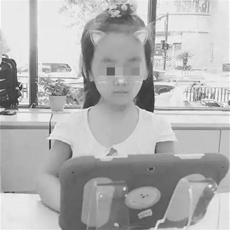 痛心杭州电瓶车自燃烧伤女孩今晨离世年仅7岁 杭州电瓶车自燃事件受伤小女孩离世 魏顺利 琪琪