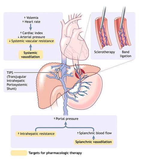 Portal Hypertension Pathophysiology