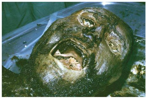 Figure 17 From The Identity Of The St Bees Lady Cumbria