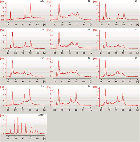 Agilent Rna Gels Samples 12 Through 22 Nntc
