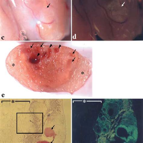 Enhanced Green Fluorescent Protein Egfp Fluorescence And Structure Of