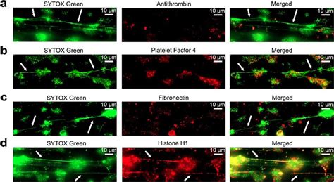 Sytox Positive Polymers Contain Histones But Not Antithrombin Download Scientific Diagram