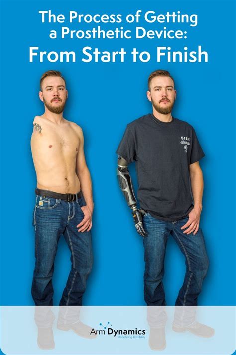 The Process Of Getting A Prosthetic Device From Start To Finish