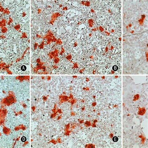 Alizarin Red S Staining For Mineralization The Calcified Nodules