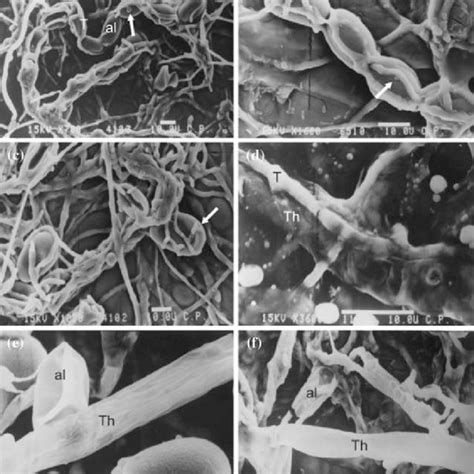 Scanning Electron Micrographs Illustrating The Mycoparasitism Of