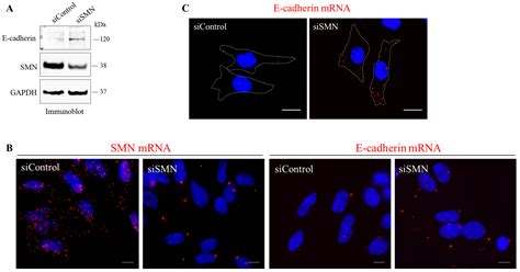 The RNA Binding Protein SMN As A Novel Player In Laryngeal Squamous