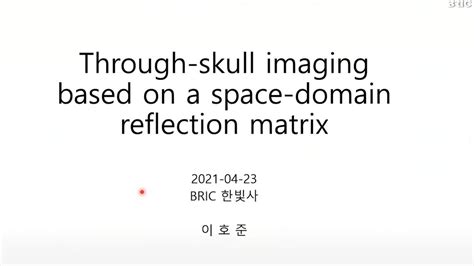 두개골 훼손 없이 신경망 관찰하는 새로운 현미경 Youtube
