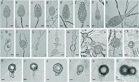 Morphology Of Phytophthora 6stagnum A G Nonpapillate And Noncaducous