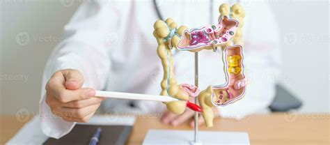 Doctor With Human Colon Anatomy Model Colonic Disease Large Intestine