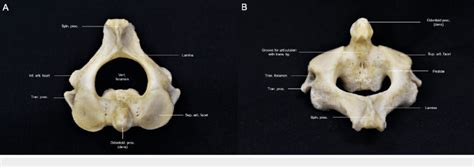 Overview Of The Axis A Superior Perspective Of The Axis Revealing