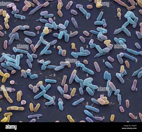 Salmonella Bacteria Coloured Scanning Electron Micrograph Sem Of