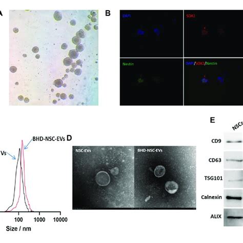 Identification Of Primary Neural Stem Cell And Extracellular Vesicles