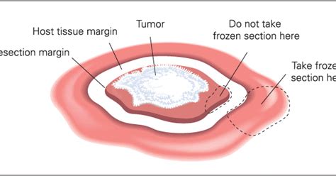 Principles Of Frozen Section Specimens