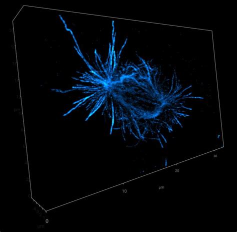Matrix Detector Abberiorrocks