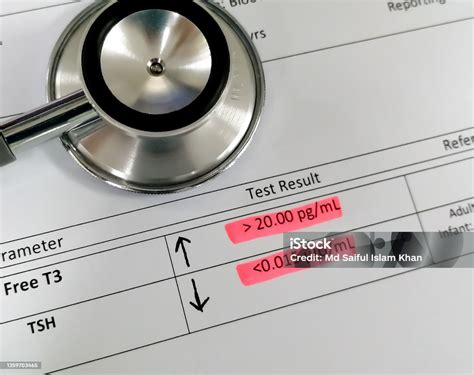 청진기로 격리된 비정상적인 갑상선 보고서 갑 상선 비정상적인 무료 T3 및 Tsh 테스트 0명에 대한 스톡 사진 및 기타 이미지