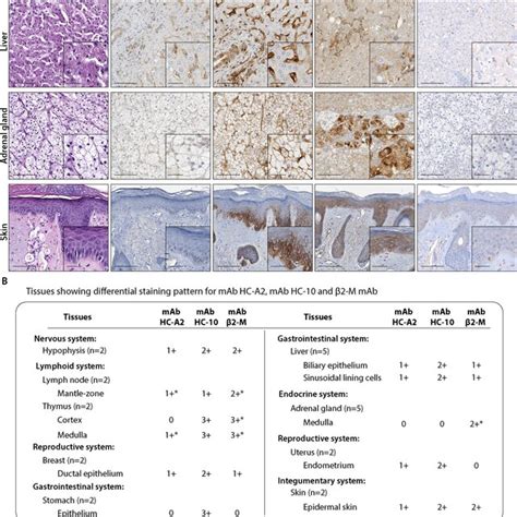A Representative Tissue Samples Showing A Barely Staining Pattern For