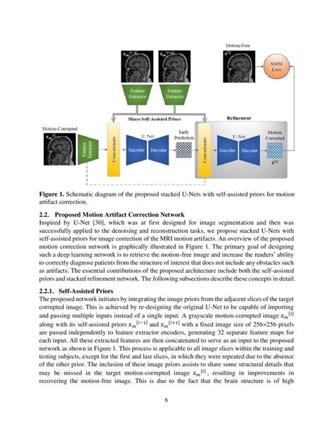 Stacked U Nets With Self Assisted Priors Towards Robust Correction Of