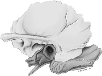 Temporal Bone External View Outside Diagram Quizlet