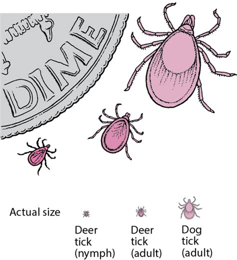 Lyme Disease Infections Merck Manual Consumer Version
